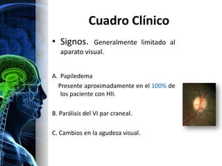 Neurocirugia pseudotumor cerebral | PDF