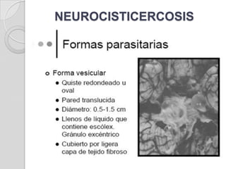 NEUROCYSTICERCOSIS | PDF