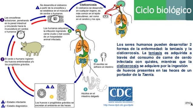 Neurocisticercosis