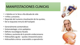 Neurocisticercosis | PPTX