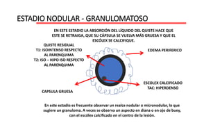 Neurocisticercosis | PPTX
