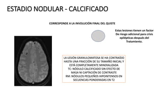 Neurocisticercosis | PPTX
