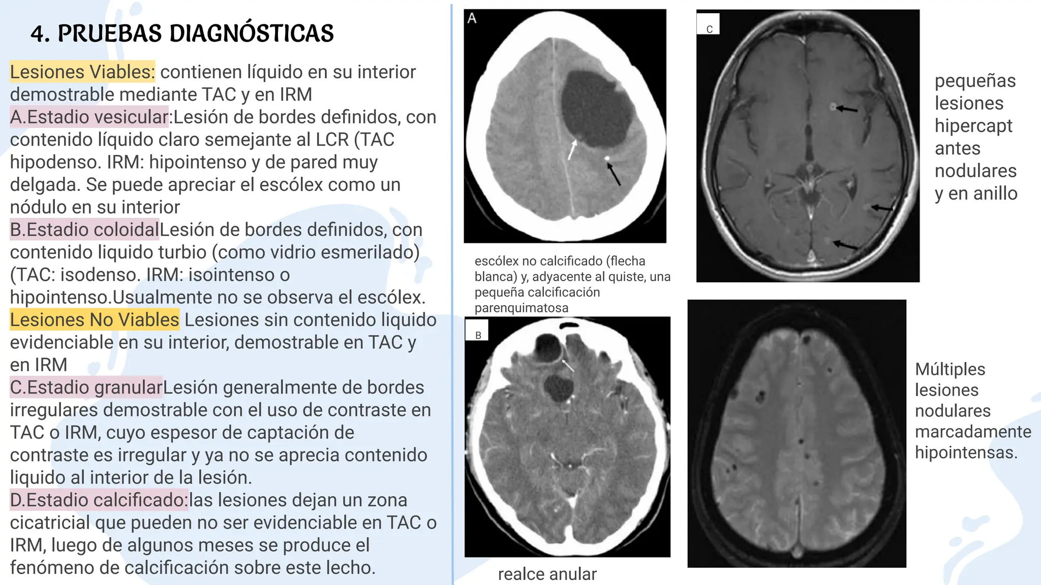 NEUROCISTICERCOSIS.pptx (1).pdf-neuroliogia | PDF
