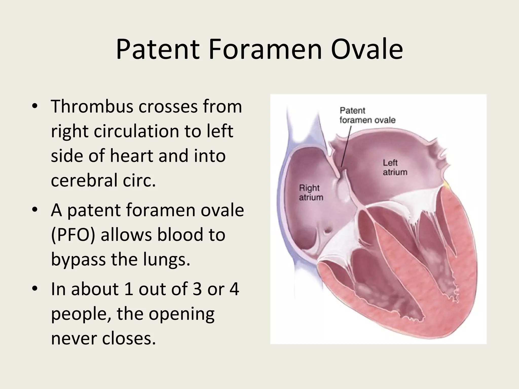 Neuro Critical Care | PPT