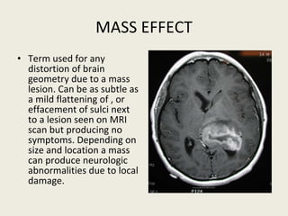 Neuro Critical Care | PPT