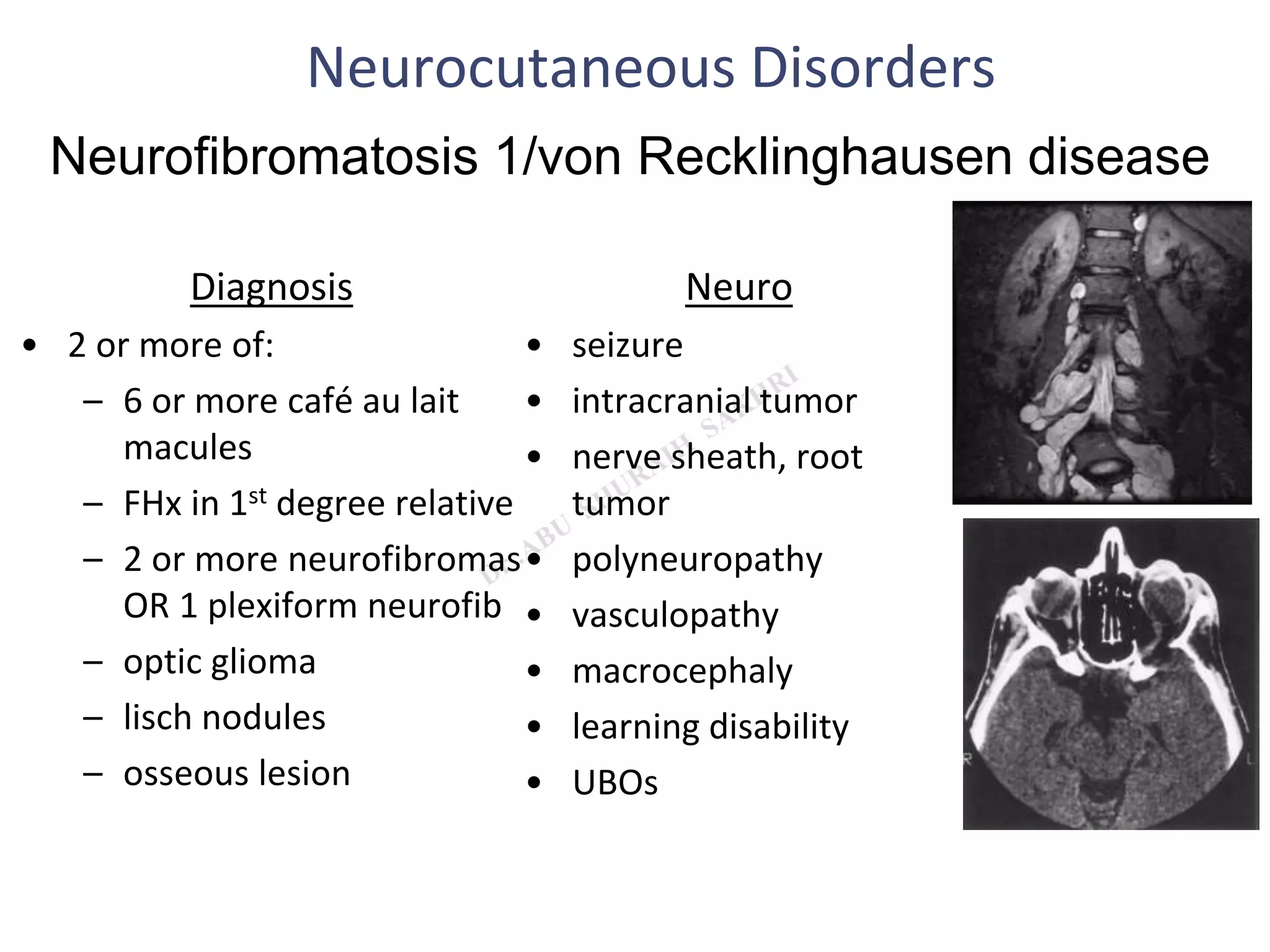 Neurocutaneous disorders | PPT