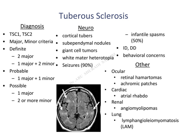 Neurocutaneous disorders