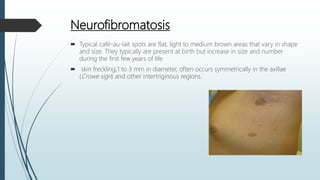 Neurocutaneous markers ..by dr shiv kumar saini | PPTX
