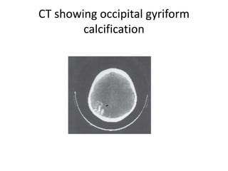 Neurocutaneous syndromes | PPTX
