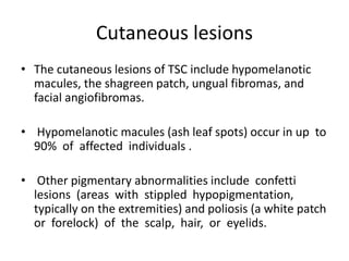 Neurocutaneous syndromes | PPTX