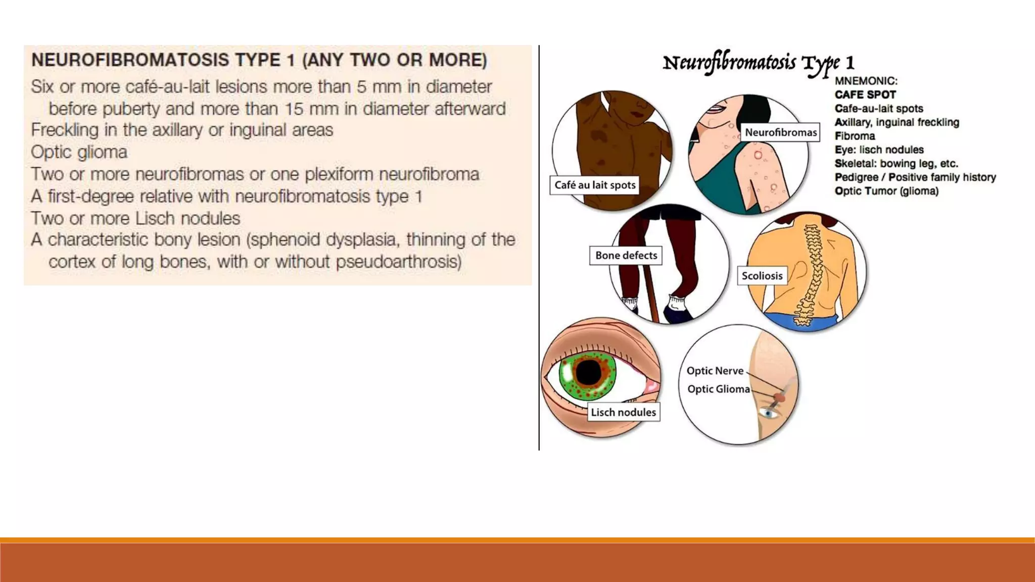 Neurocutaneous syndromes | PPTX | Brain and Nervous System Disorders ...