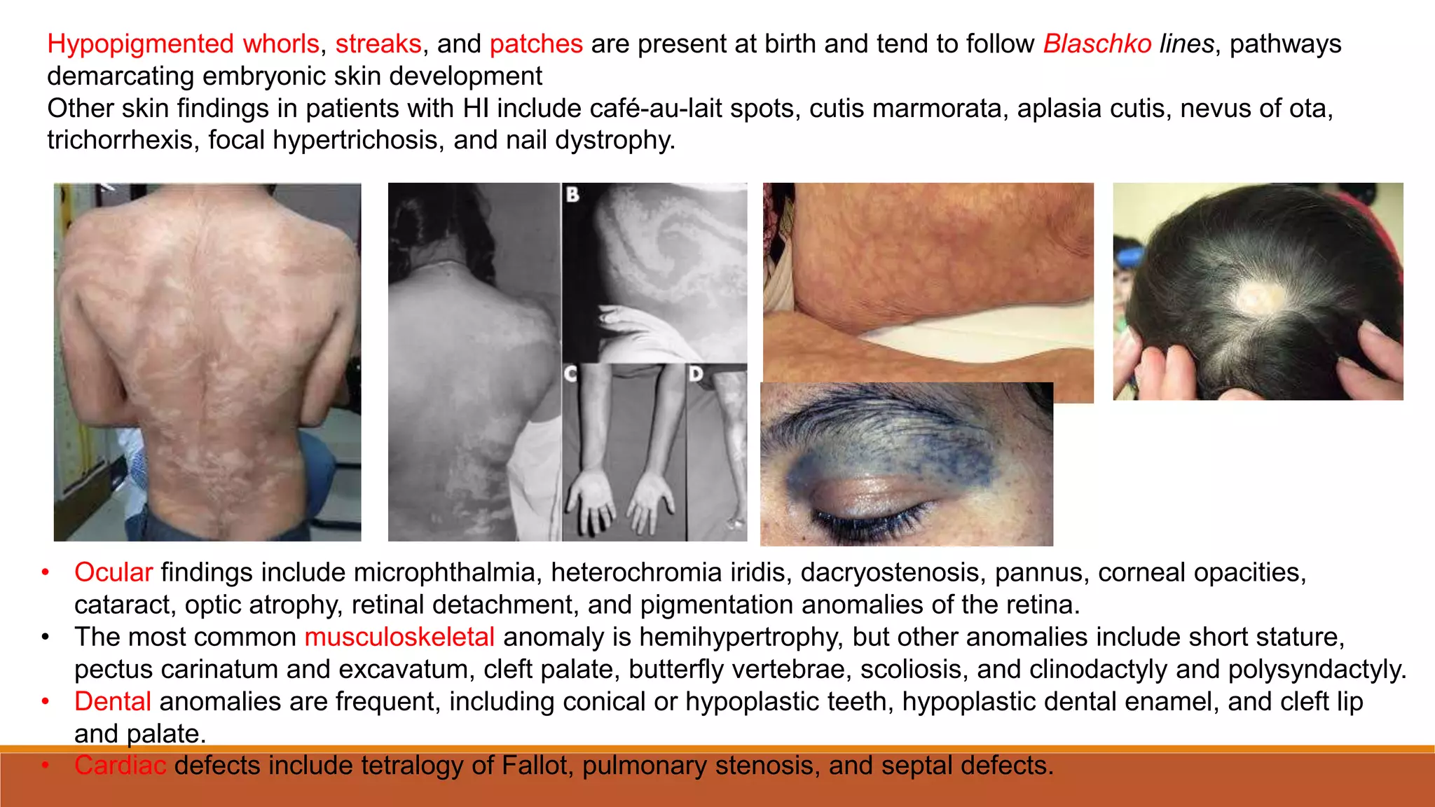 Neurocutaneous syndromes | PPTX | Brain and Nervous System Disorders ...