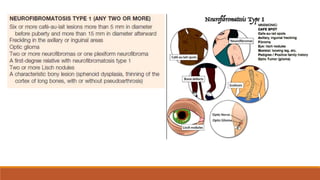 Neurocutaneous syndromes | PPTX