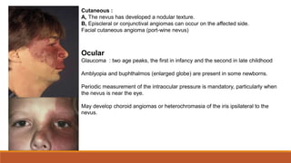 Neurocutaneous syndromes | PPTX