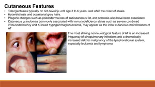 Neurocutaneous syndromes | PPTX