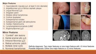 Neurocutaneous syndromes | PPTX