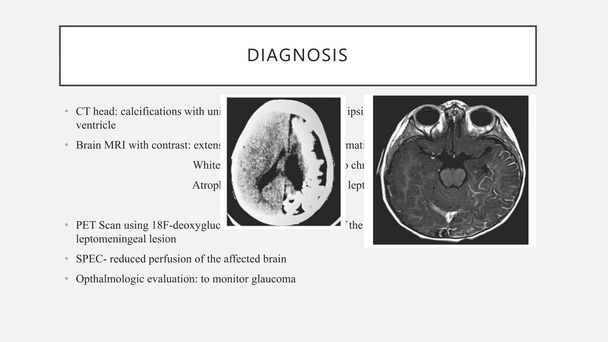 Neurocutaneous syndromes.pptx
