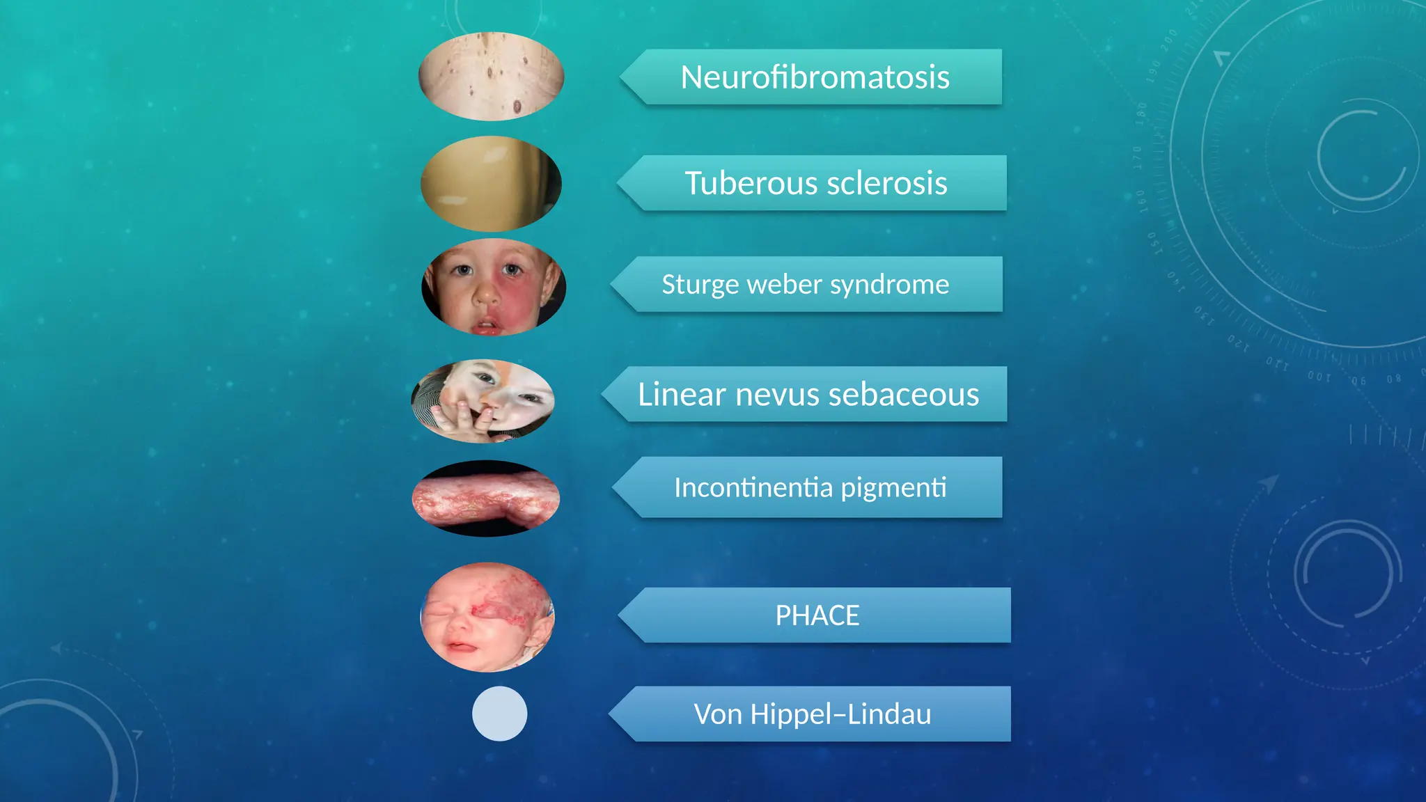 neurocutaneous syndromes . child neurology | PPTX