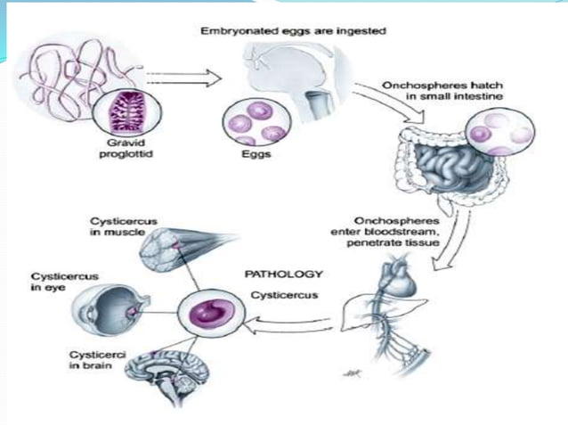 Neurocysticercosis | PPTX