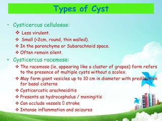 Neurocysticercosis ppt irin1 | PPTX