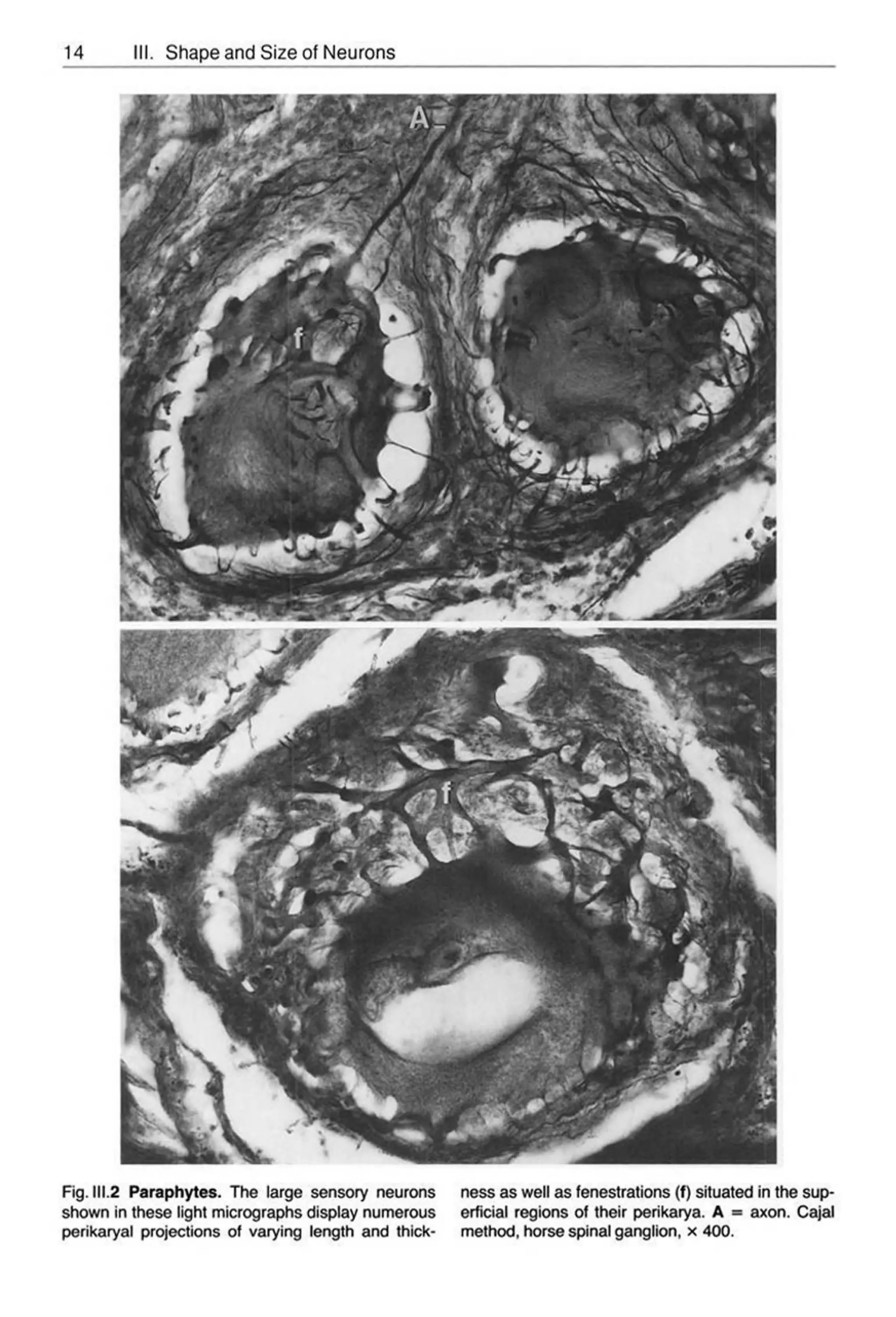 Neurocytology fine structure.... pannese, 1994 | PDF