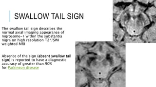 Neurodegenerative disorders MRI approach | PPT