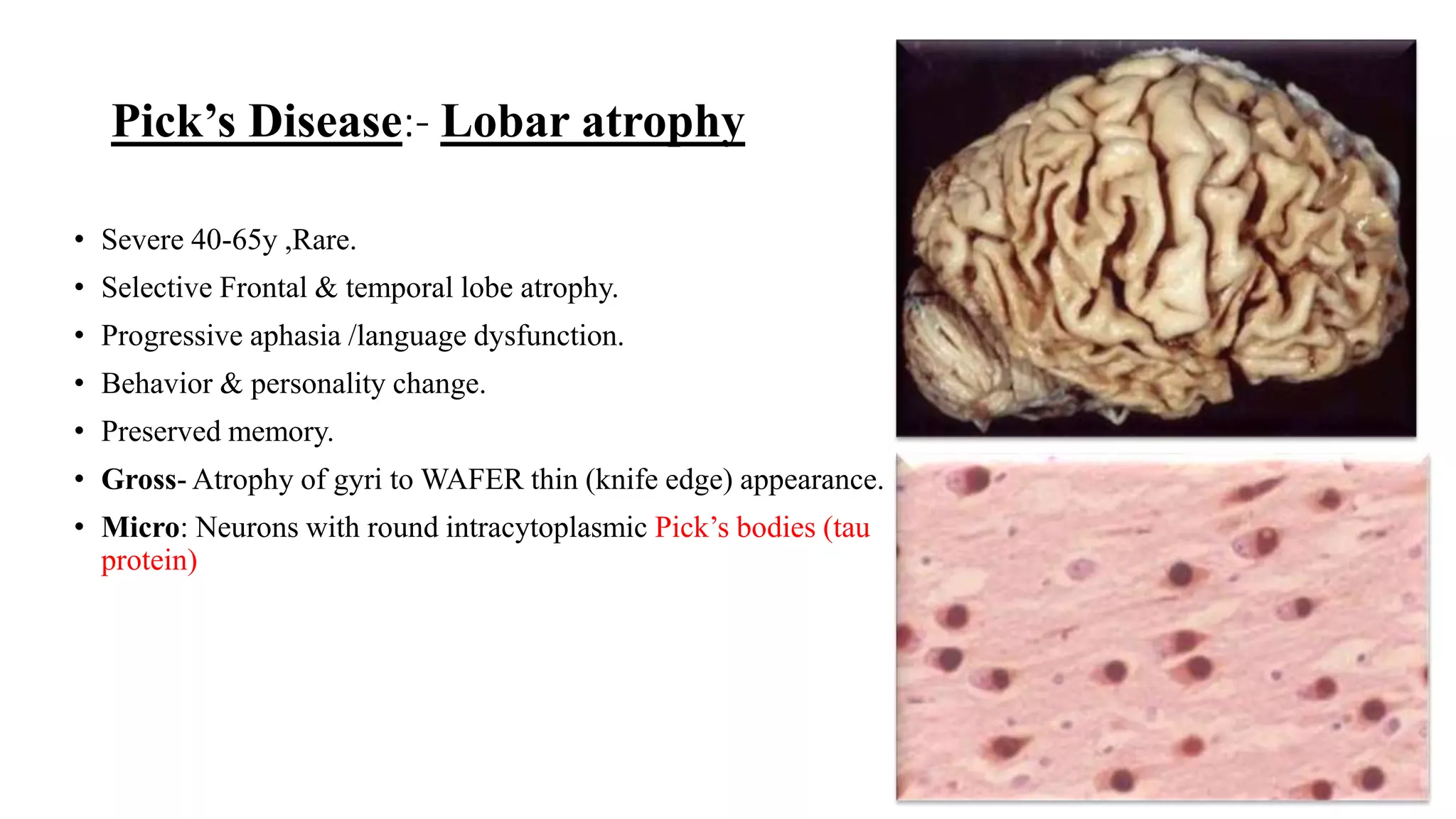 Neurodegerative Disorder.pptx
