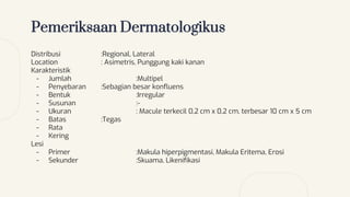 Neurodermatitis 2 prsentation slide.pptx