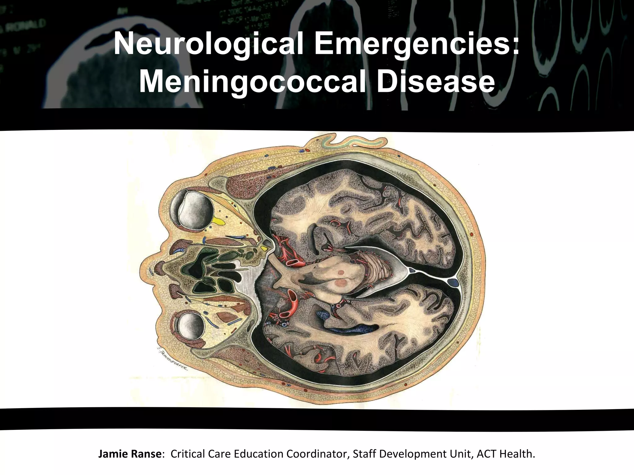Neurological Emergencies | PPT