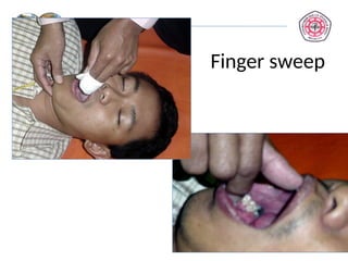 neuroemergensi pada bagian syaraf dan kedokteran.ppt