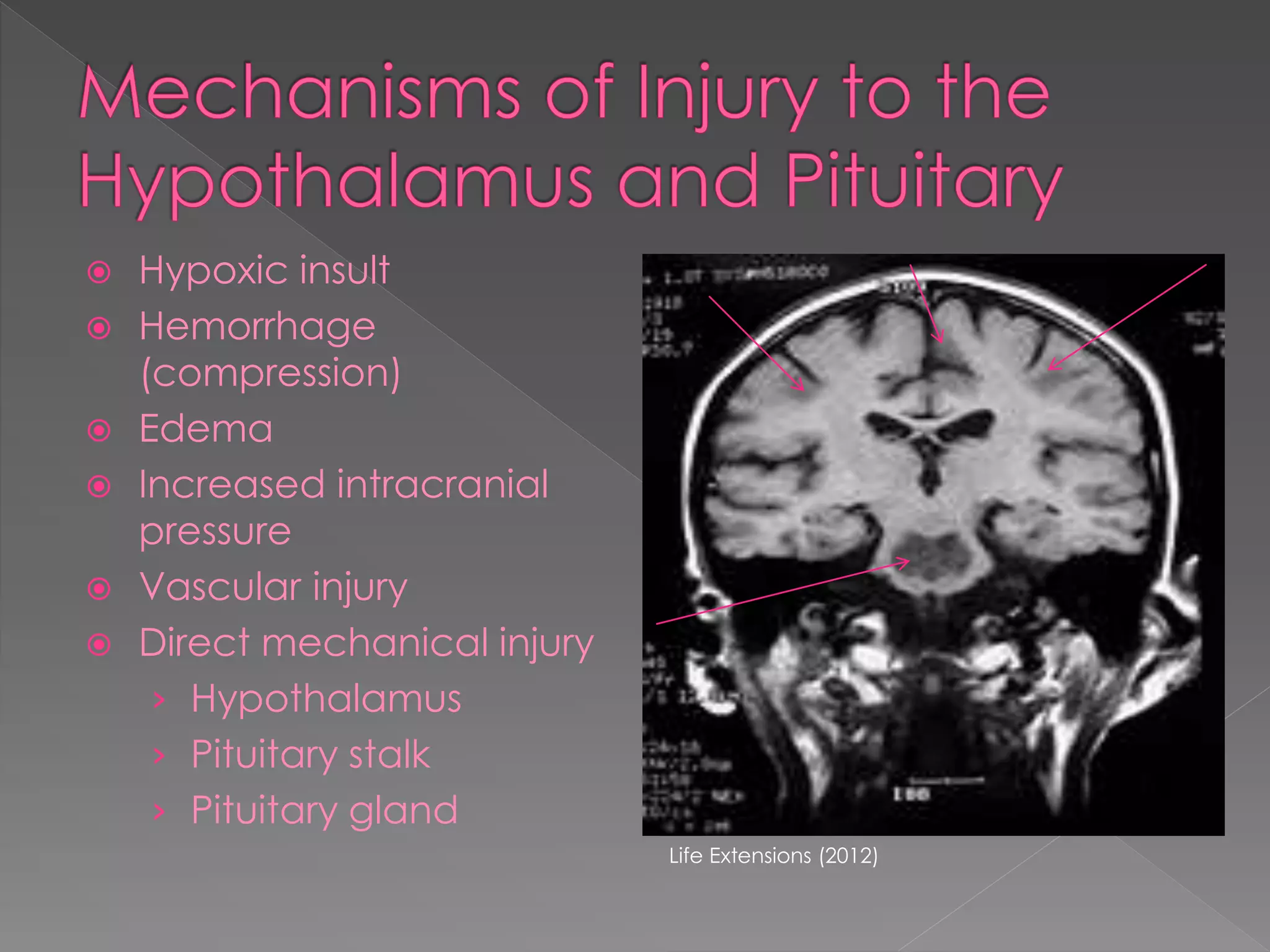 Neuroendocrine dysfunction following traumatic brain injury | PPTX