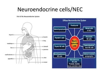 gastrointestinal Neuro endocrine tumors , GIT NET | PPTX