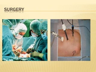 Understanding GEP NET Cancer | PPTX