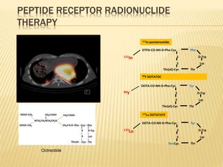 Understanding GEP NET Cancer | PPTX