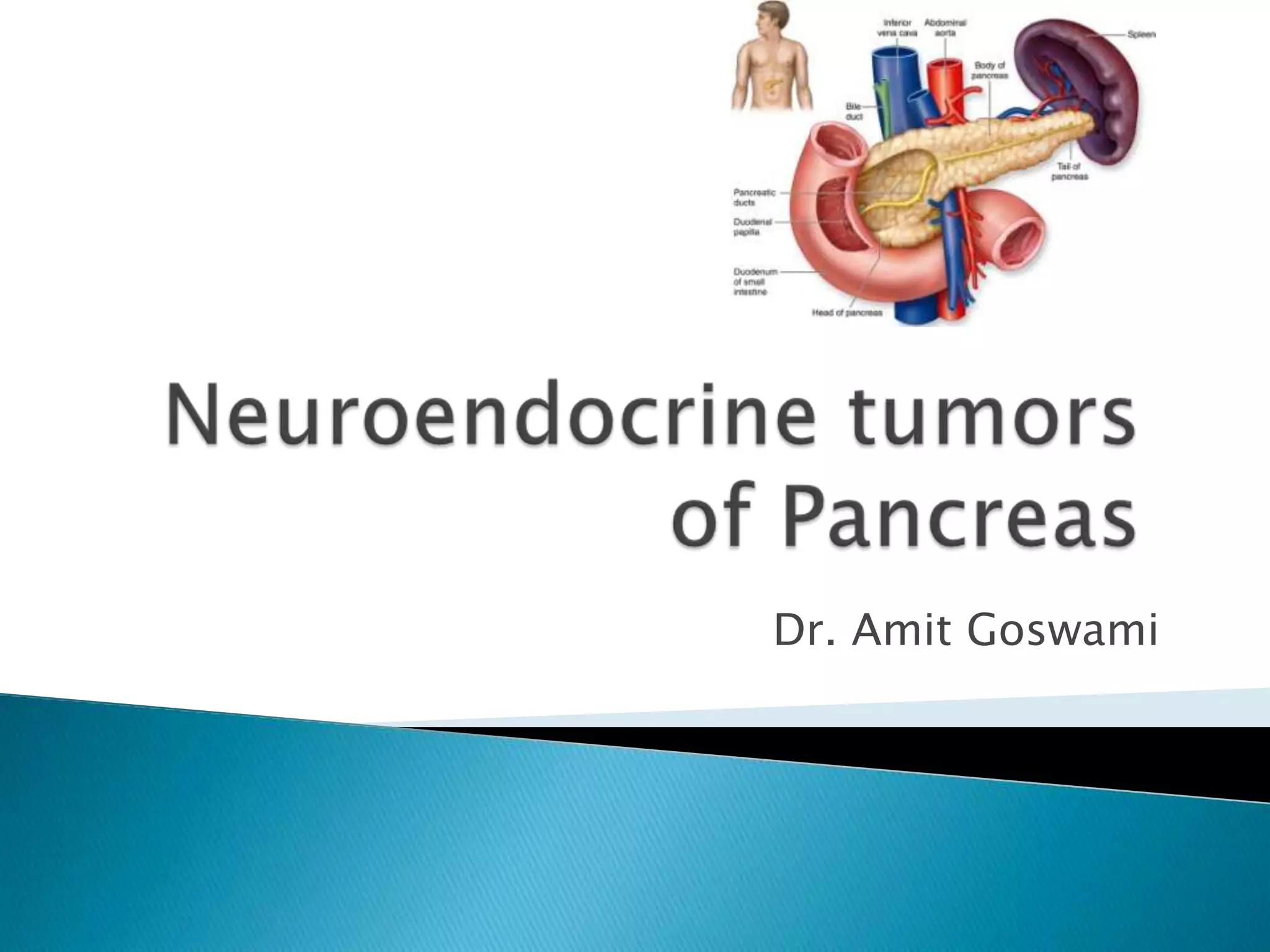 Neuroendocrine tumors of pancreas | PPTX