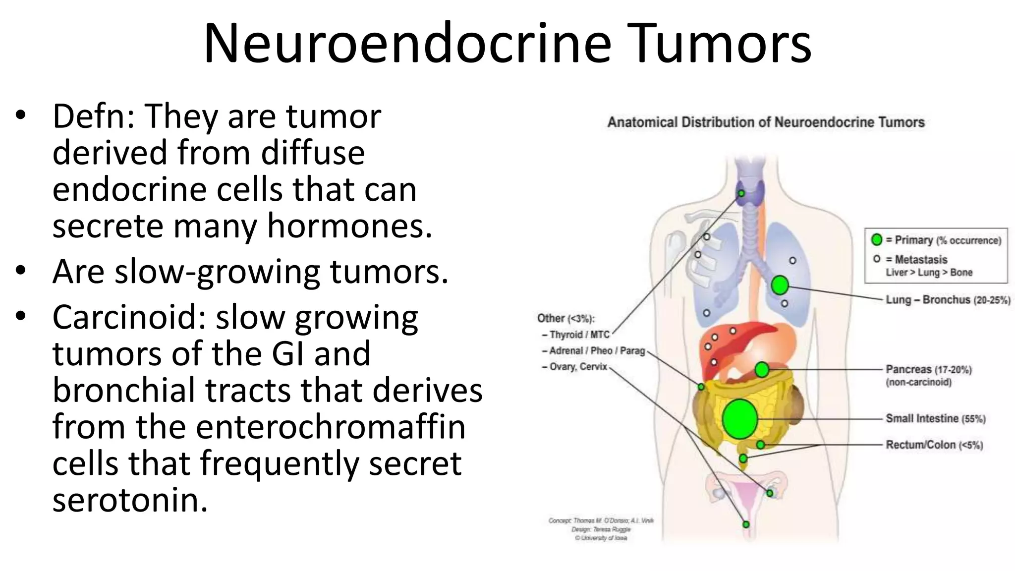 Neuroendocrine tumors of pancreas | PPTX