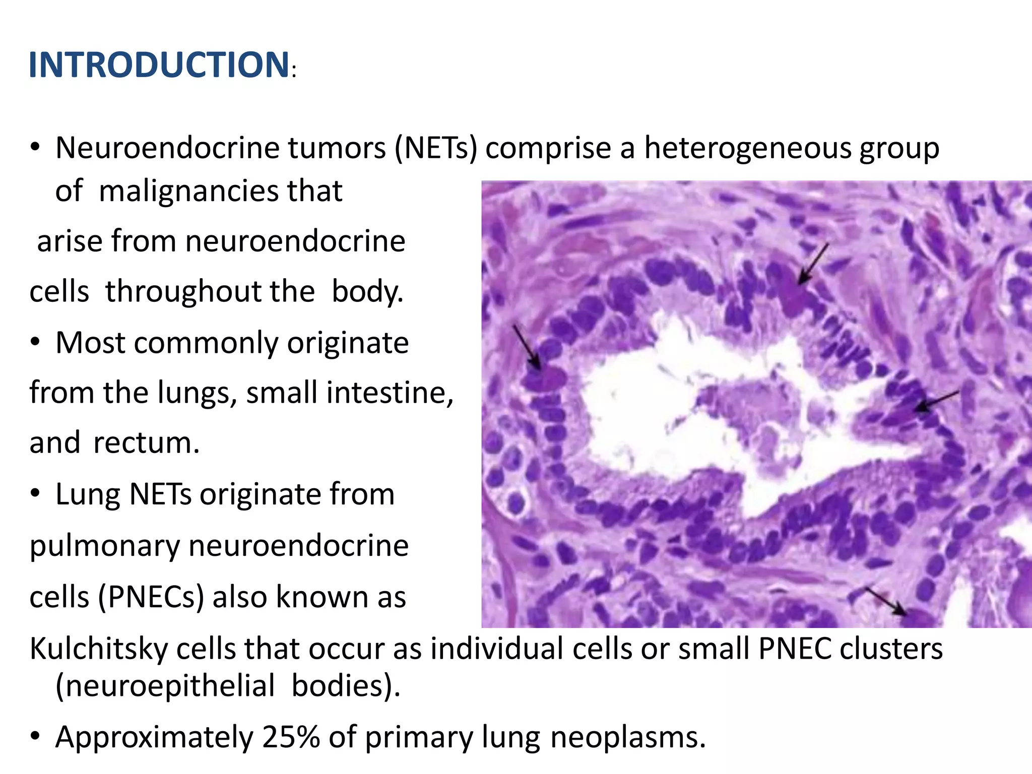 Neuroendocrine tumors of the lung (seminar) | PPTX