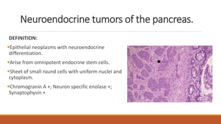 Neuroendocrine tumors of the pancreas | PPTX