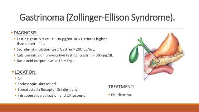 Zollinger Ellison Syndrome Treatment