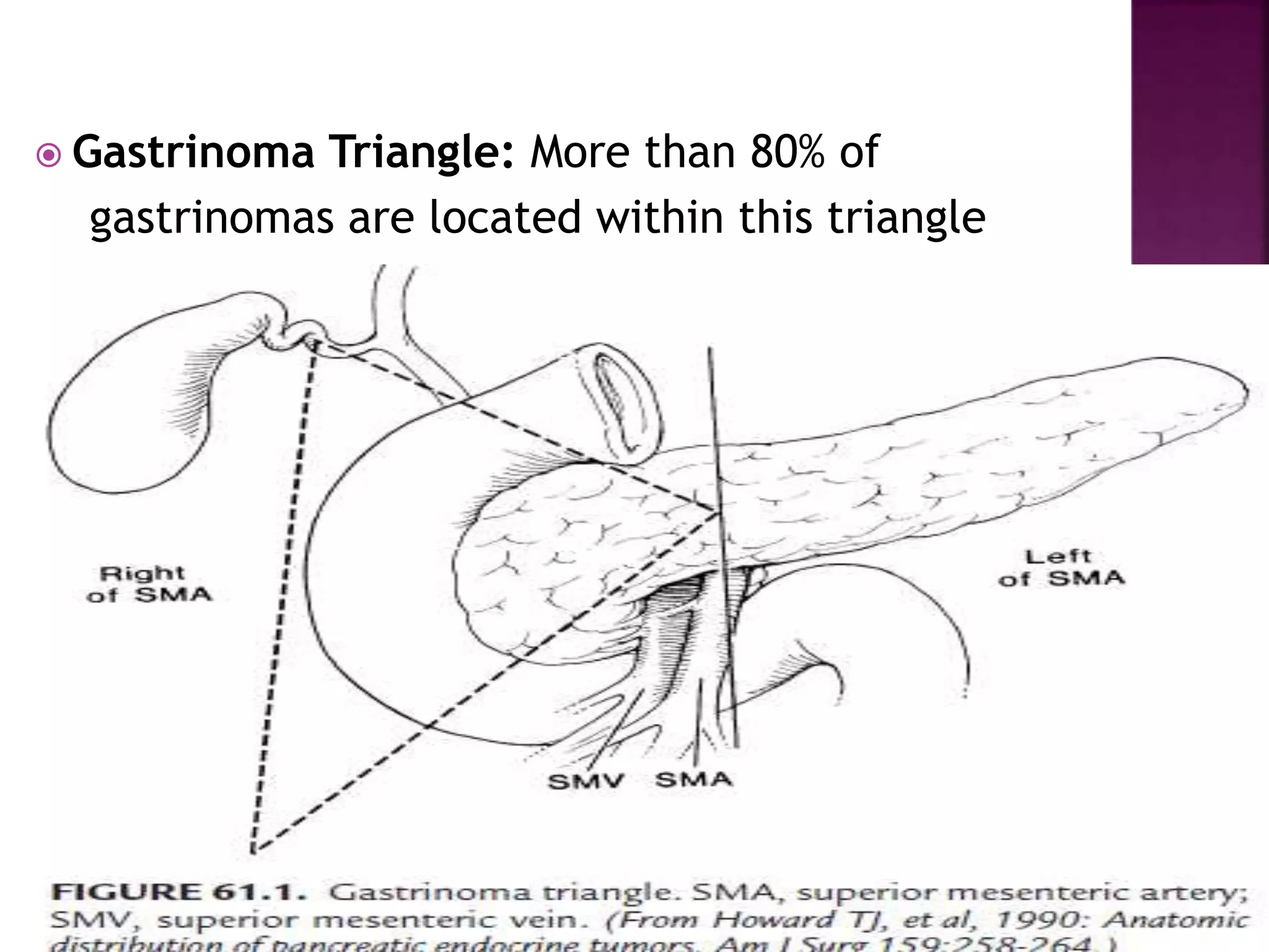 Neuroendocrine tumors of the pancreas | PPTX