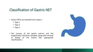Neuroendocrine tumors (Gastroduodenal) | PPTX