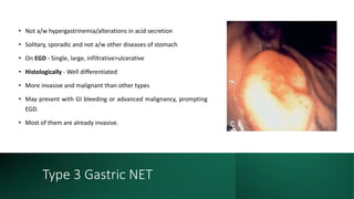 Neuroendocrine tumors (Gastroduodenal) | PPTX