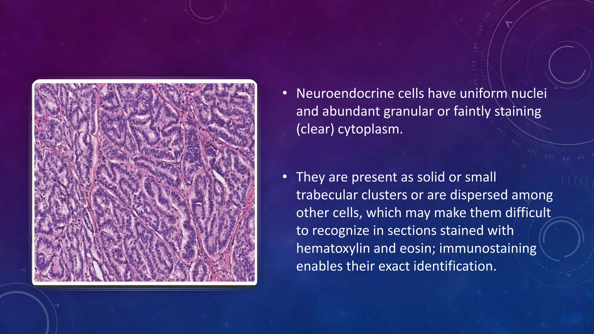 Neuroendocrine tumours.pptx