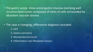 Neuroendocrine tumours.pptx
