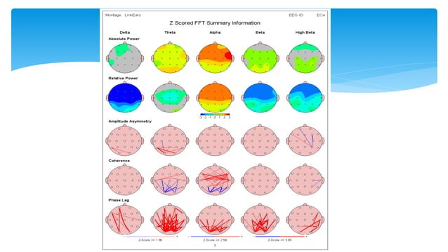 Neurofeedback as Treatment of Autism Spectrum Disorder- | PPT