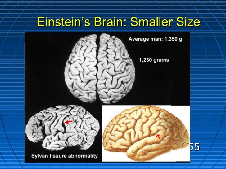 Homo Capensis (Boskop Man) | Somali Spot | Forum, News, Videos