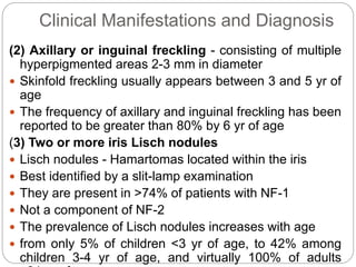 Neurofibromatosis | PPTX