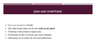 Neurofibromatosis.pptx