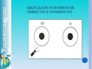 Neuroftalmologia FMH UNPRG Tucienciamedic | PPT