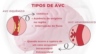 Mapa sobre Acidente Vascular Encefalico Isquêmico ou hemorrágico | PDF